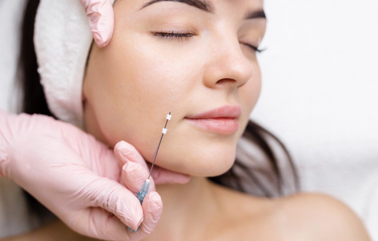 Thread Lift Adelaide | Face And Body skin clinic