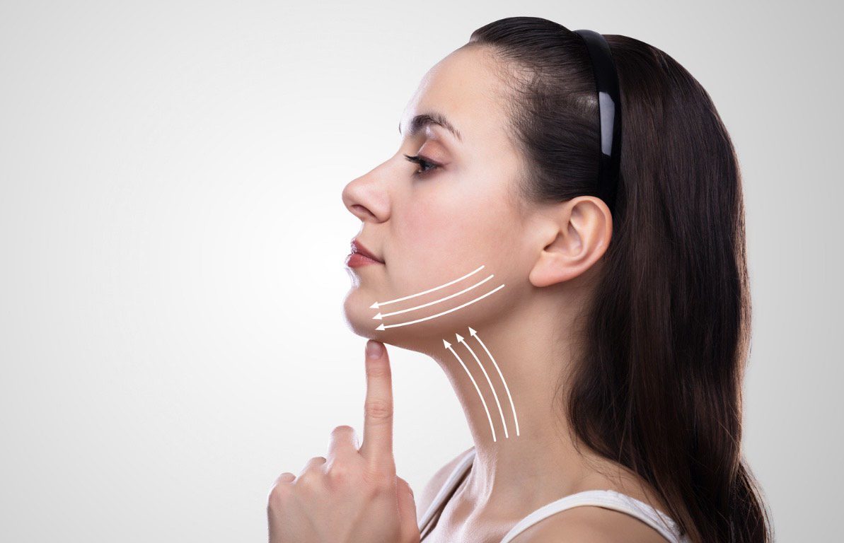 Thread Lift Adelaide | Face And Body skin clinic